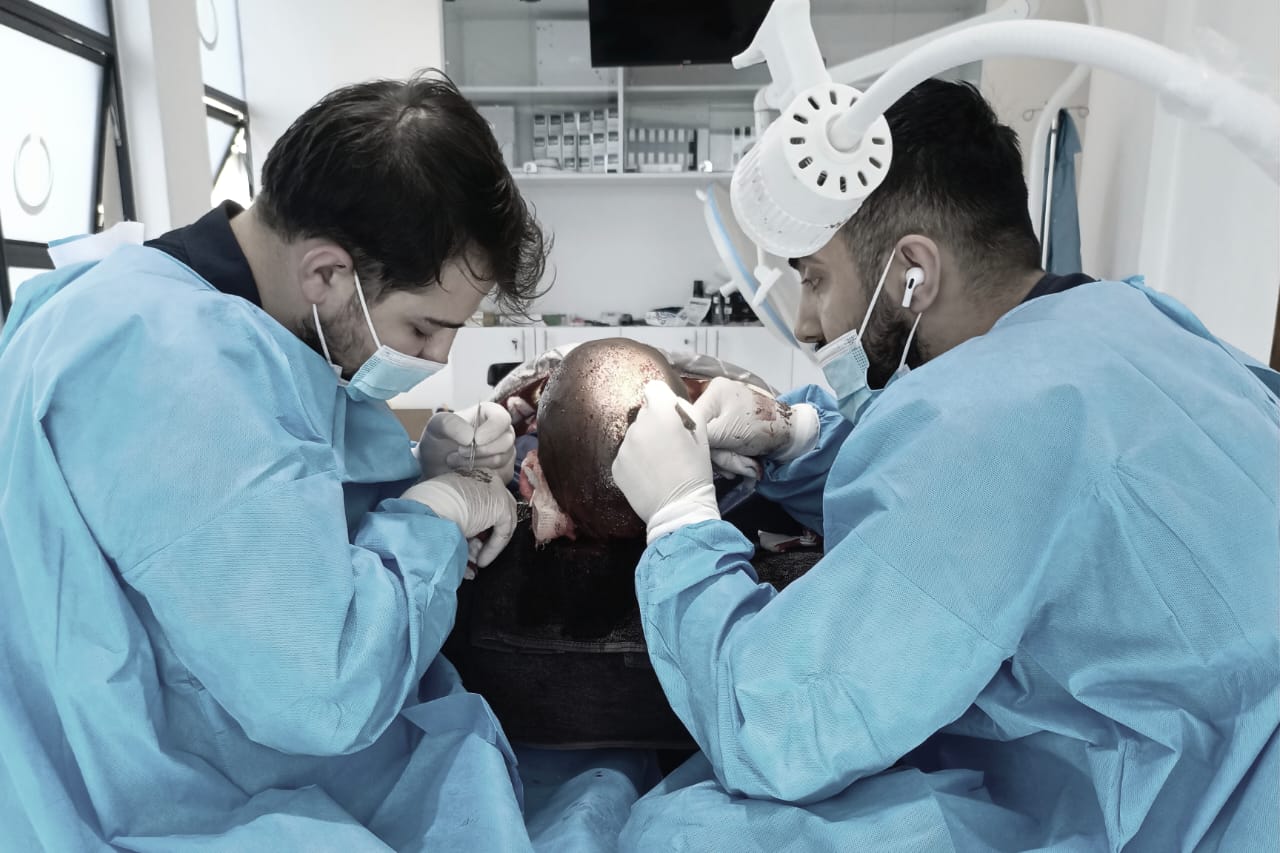 Hair Transplant in Kampala | Turkish Hair Experts Uganda